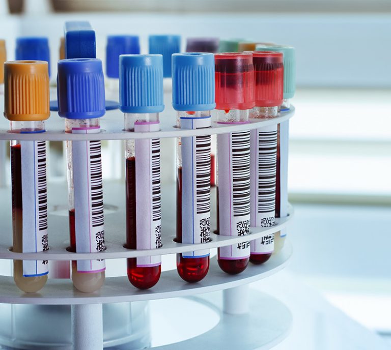 Teknogin: Pruebas Complementarias